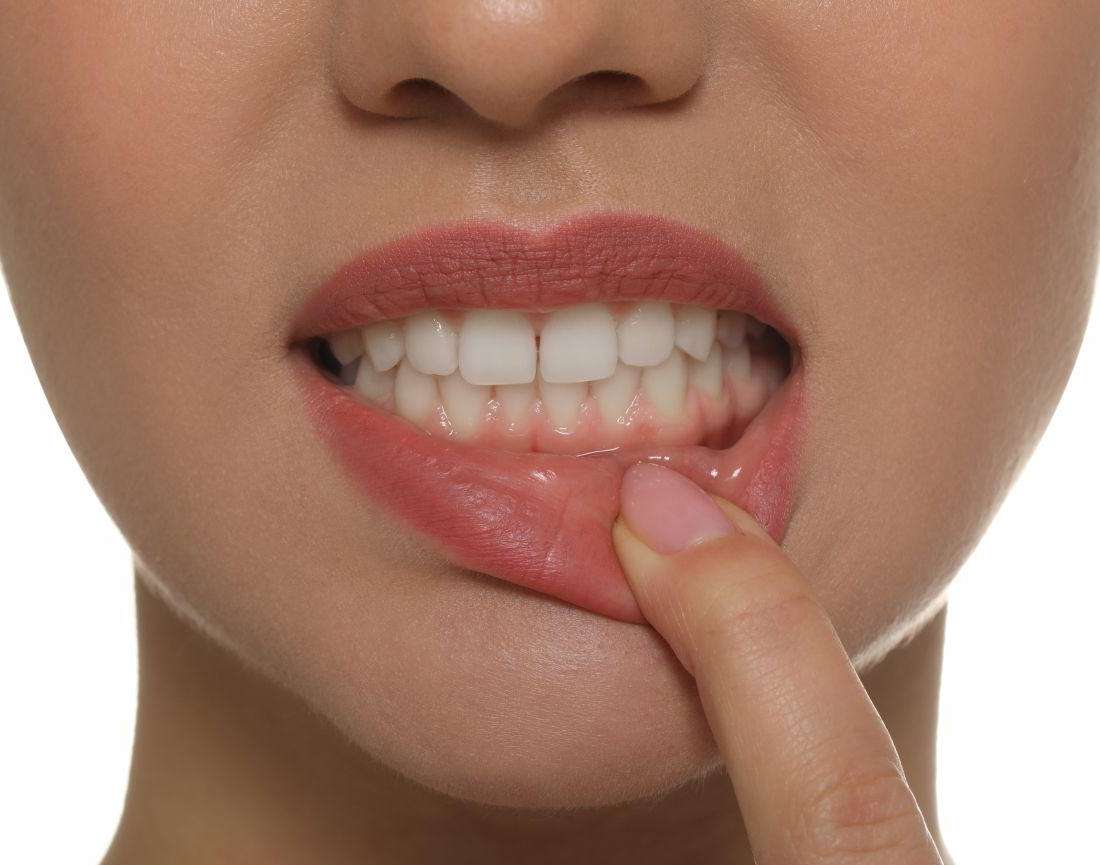 Receding Gums: Home Care or Dentist? | General Dentistry Narre Warren